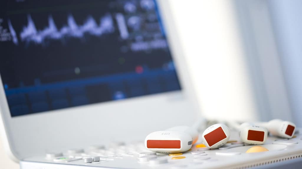 93015 CPT Code Guide: Stress Testing Billing & Documentation