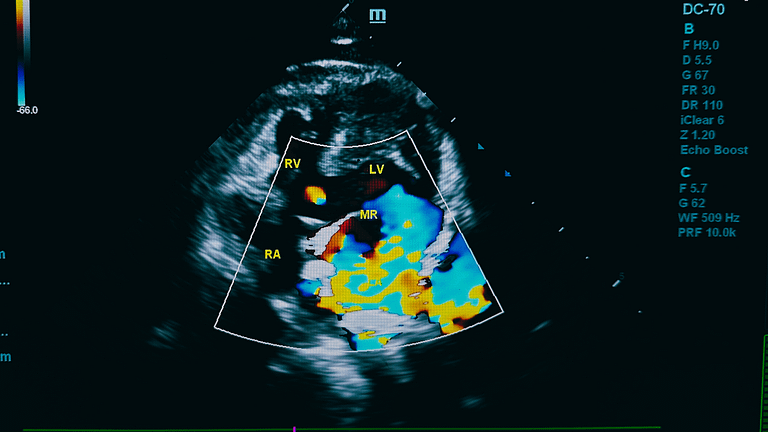 96136 CPT Code Billing Guide